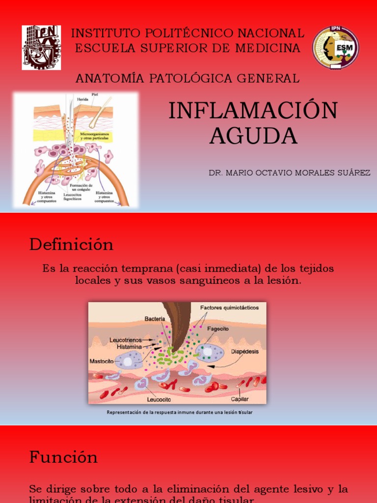 INFLAMACIÓN AGUDA.pptx | PDF | Inflamación | Medicina