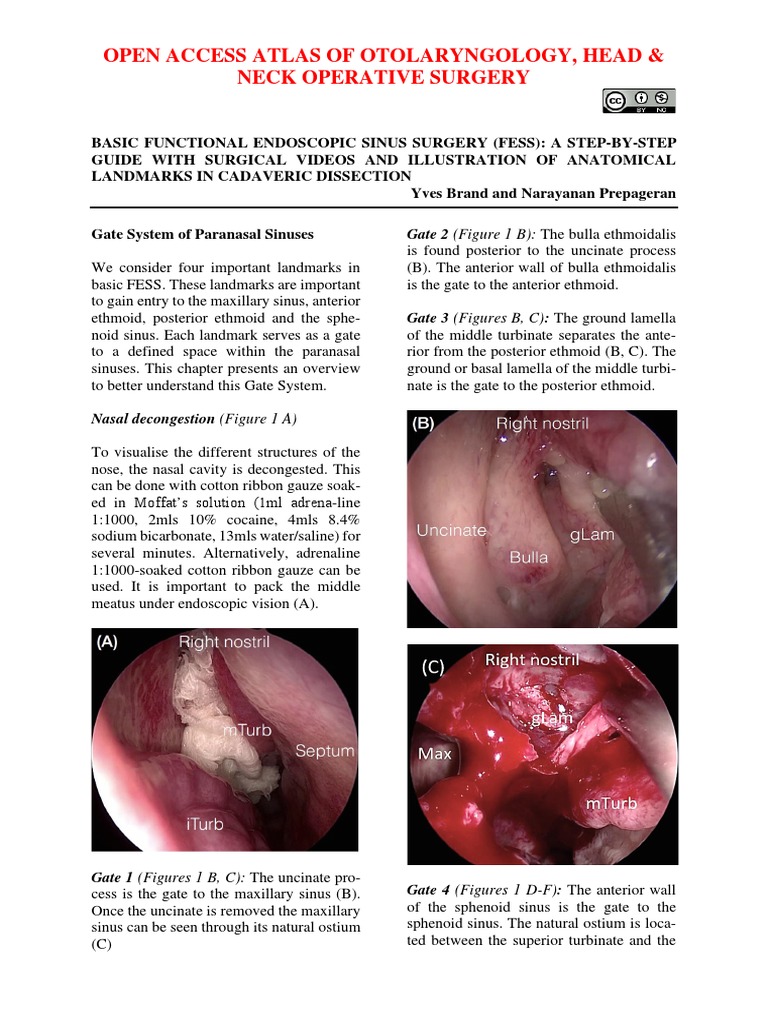 Basic FESS - Step-By-Step Guide With Surgical Videos PDF | PDF | Human ...