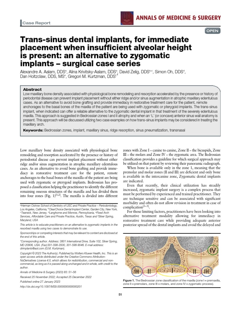 Trans Sinus Dental Implants For Immediate.11 | PDF