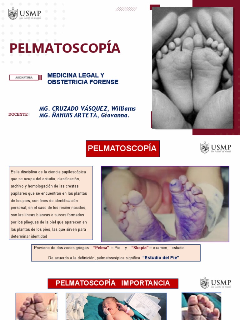 14°semana Pelmatoscopía | PDF