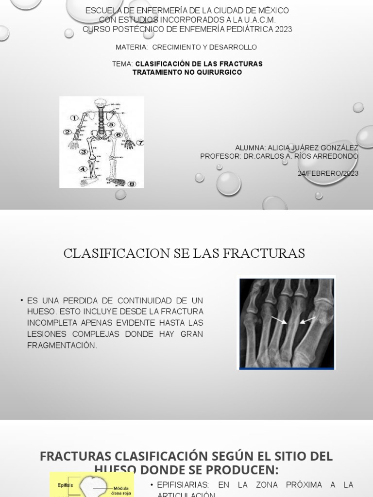 Fracturas Clasificacion | PDF | Hueso | Lesión