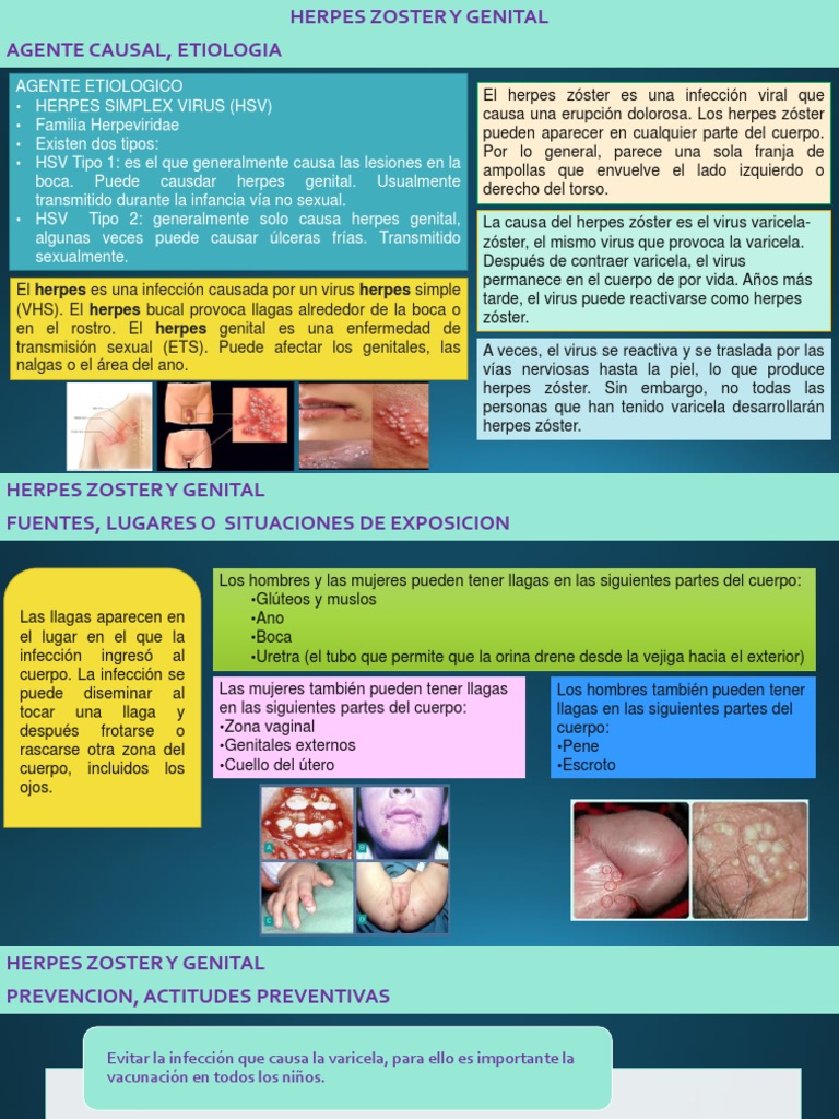 Herpes Zoster | PDF | Herpes Simple | Virus