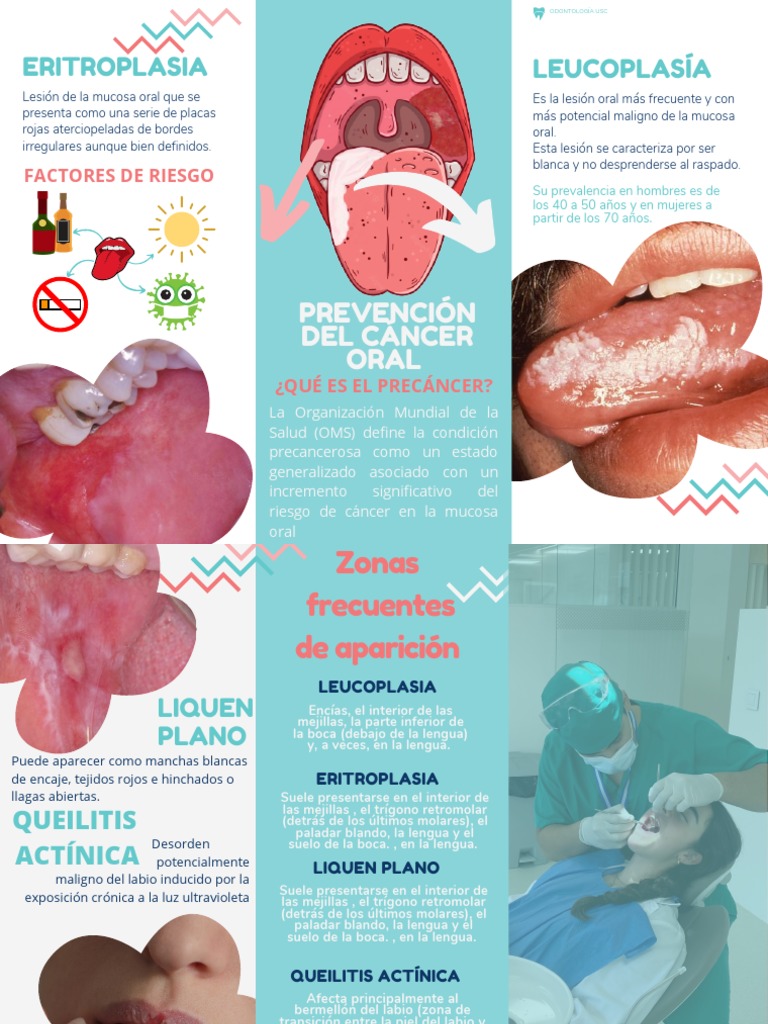 DÃ Ptico Precancer Oral Pdf Cáncer Odontología