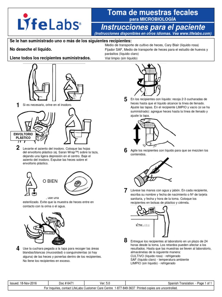 Collection of Stool For Culture Parasitology or Clostridium Difficile ...