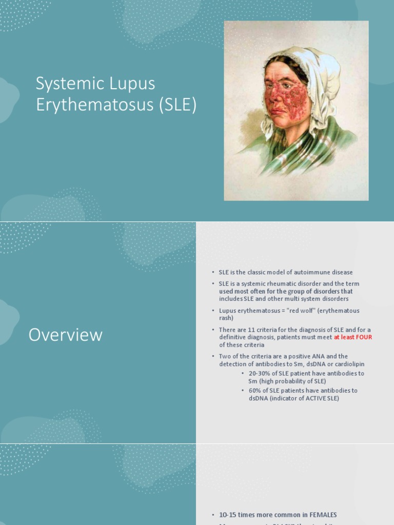 Systemic Lupus Erythematosus | PDF | Medical Specialties | Immune System