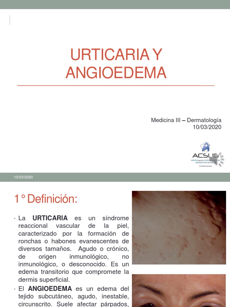 Urticaria. Eritema Multiforme. SD Steven Jhonson. | PDF | Sistema ...