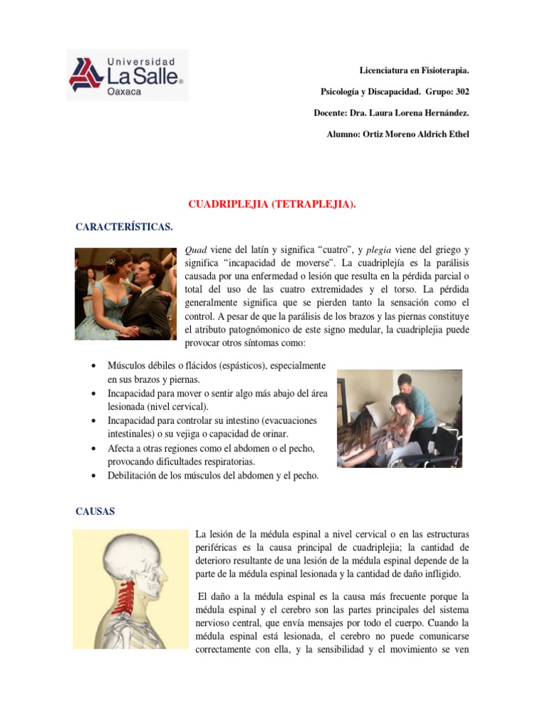 CUADRIPLEJIA | PDF | Parálisis cerebral | Médula espinal