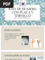 Técnica Quirúrgica Placa Philos: Conceptos | PDF | Tornillo | Metalurgia