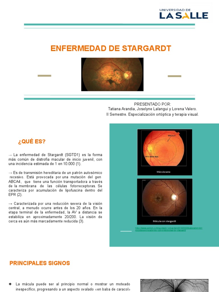 Enfermedad de Stargardt: Diagnóstico y Síntomas | PDF | Oftalmología ...