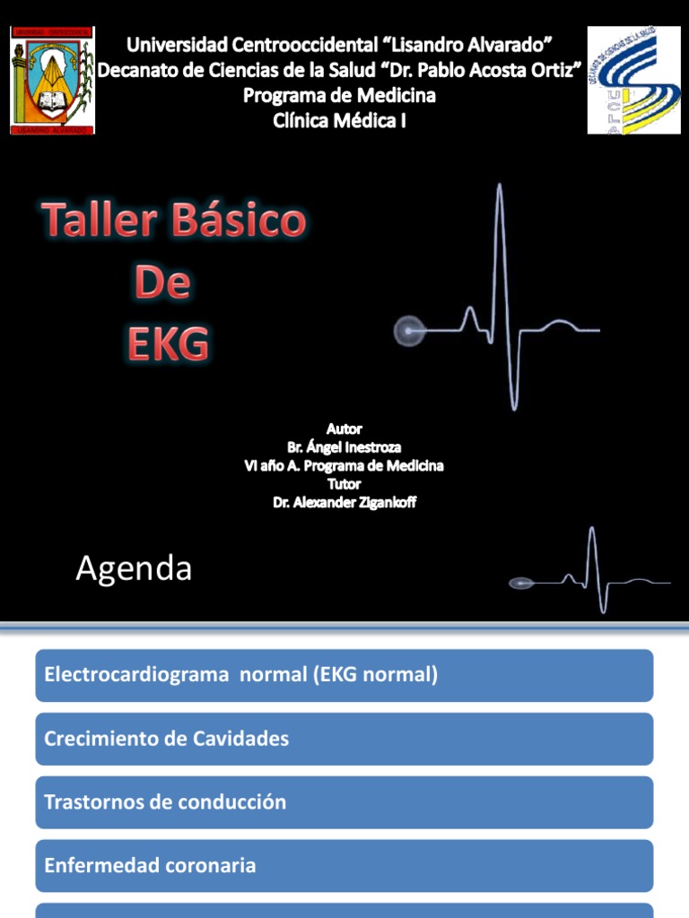 EKG Normal | PDF | Electrocardiografia | Órgano (anatomía)