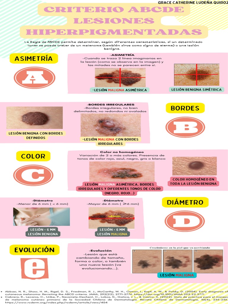 Criterio Abcde S13 Ludeña Quiroz Grace PDF | PDF