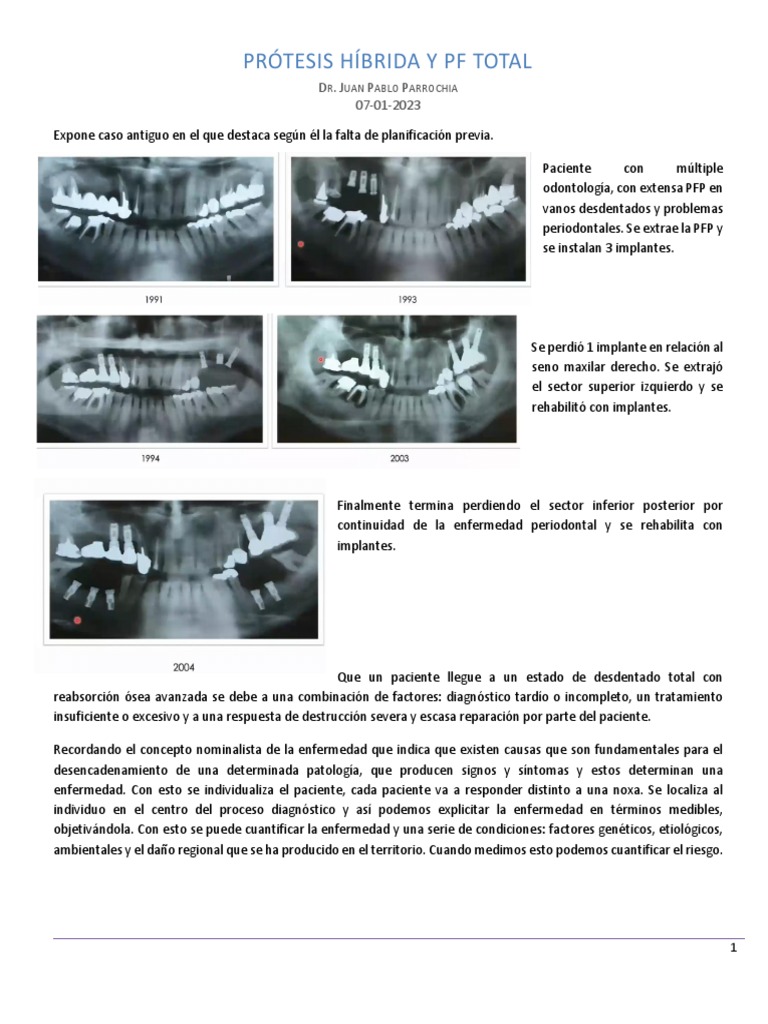 Protesis Hibrida y PF Total | PDF | Dentadura postiza | Implante dental