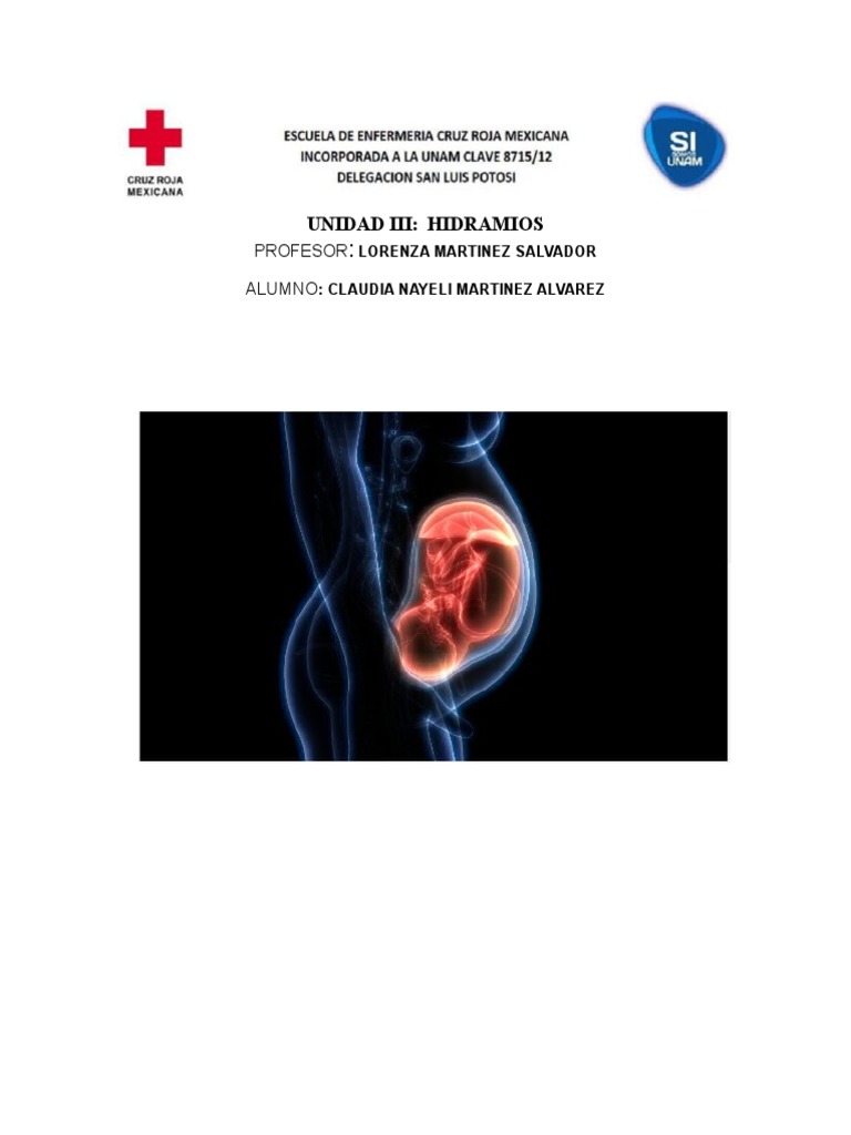 Hidramnios: Causas y Síntomas | PDF