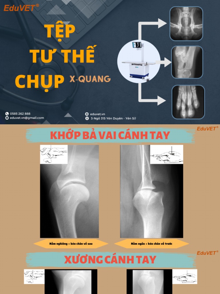 TỆP TƯ THẾ CHỤP X-QUANG | PDF