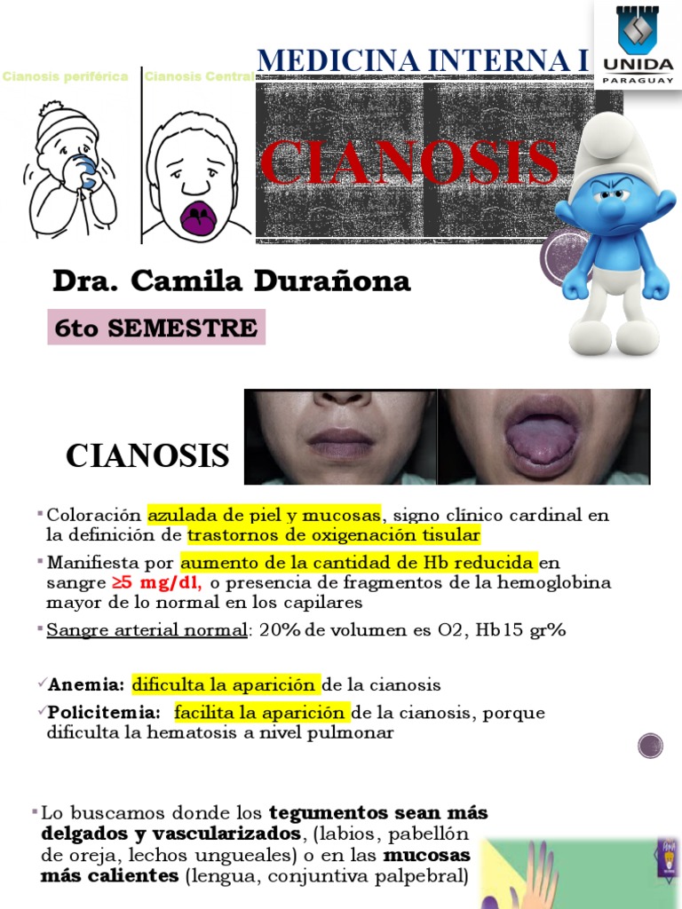 4 - Semiologia de La Cianosis | PDF | Sistema circulatorio | Defecto ...
