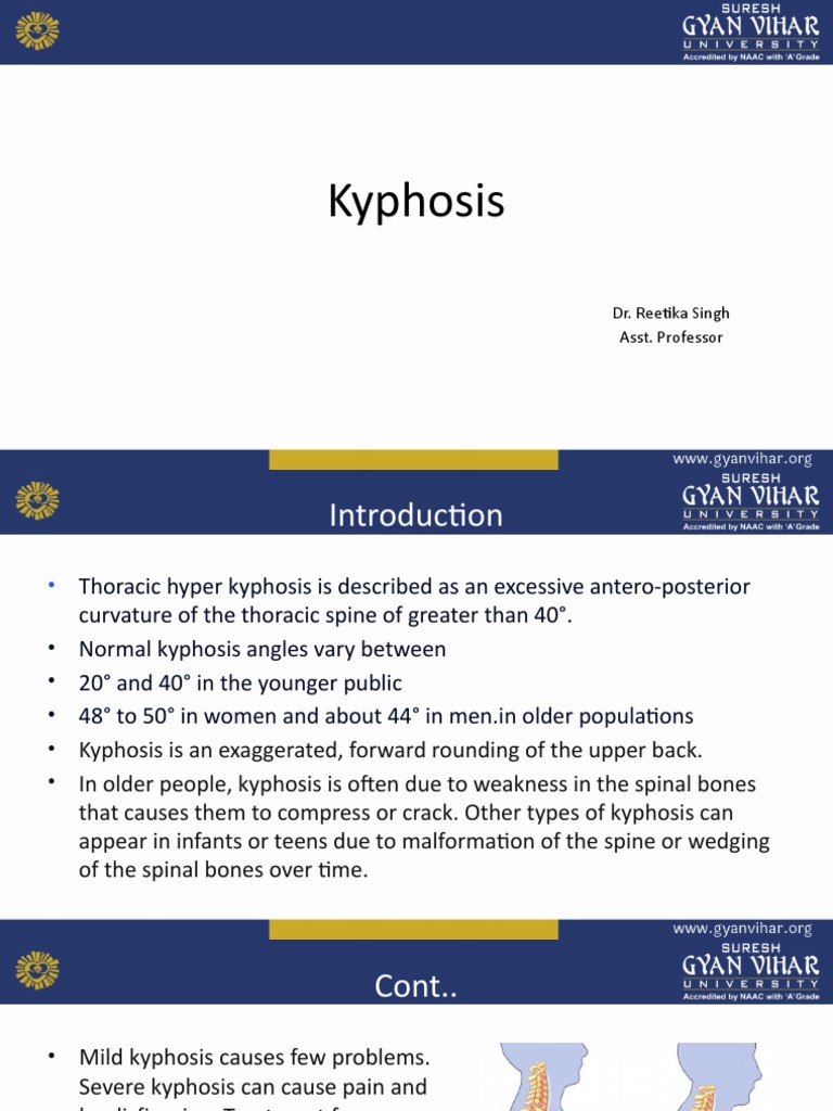 Kyphosis | PDF | Vertebral Column | Musculoskeletal System