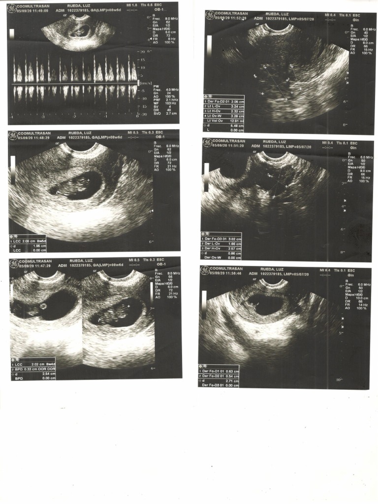 Ecografia Luz Dary Duarte | PDF