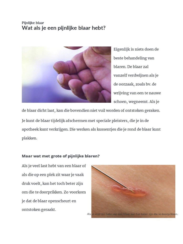 Pijnlijke Blaar | PDF