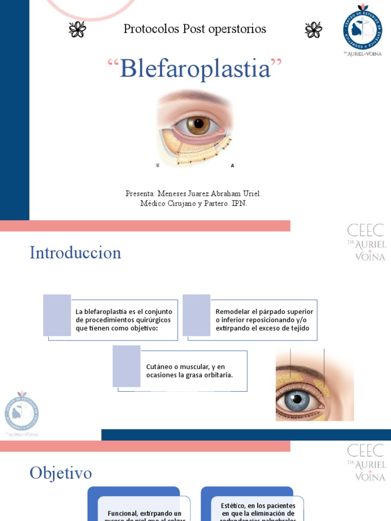 Blefaroplastia | PDF | Especialidades Medicas | Medicina CLINICA