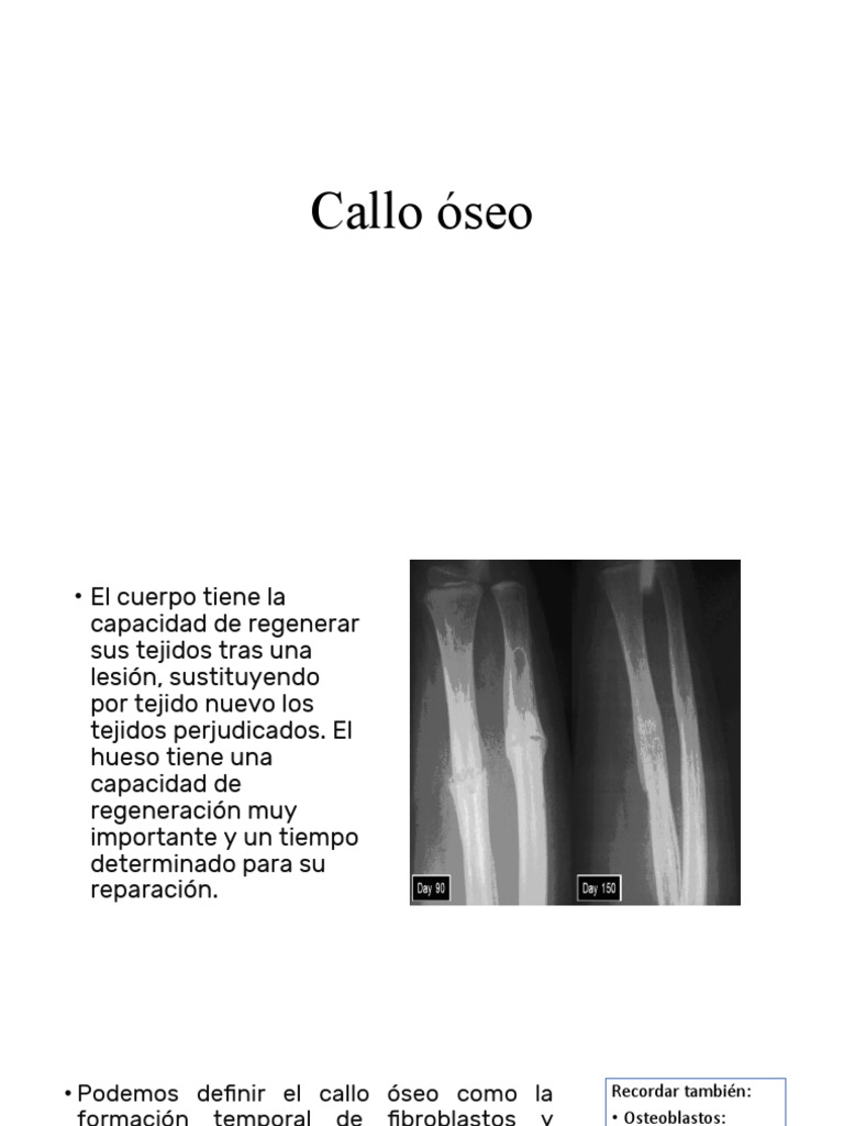 Callo óseo | PDF | Hueso | Inflamación