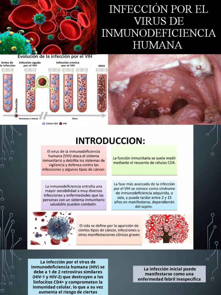 Infección por VIH: Etapas y Diagnóstico | PDF | VIH | Ciencias de la Salud