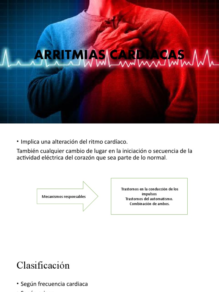 Arritmias Cardiacas | PDF