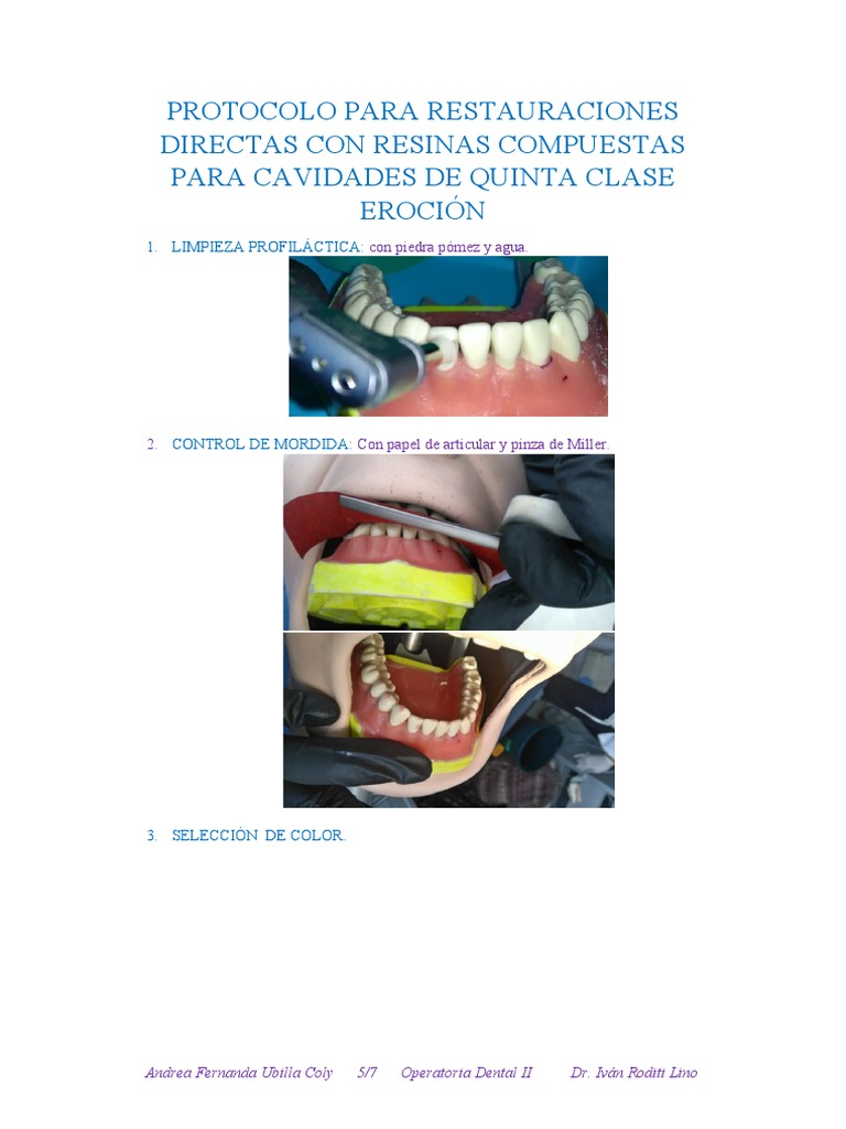 7.-Protocolo para Restauraciones Directas Con Resinas Compuestas para Cavidades de Quinta Clase ...