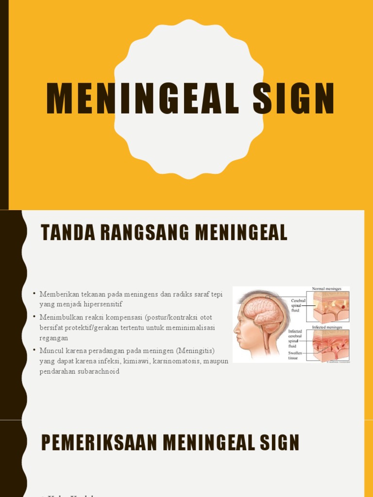 Meningeal Sign | PDF