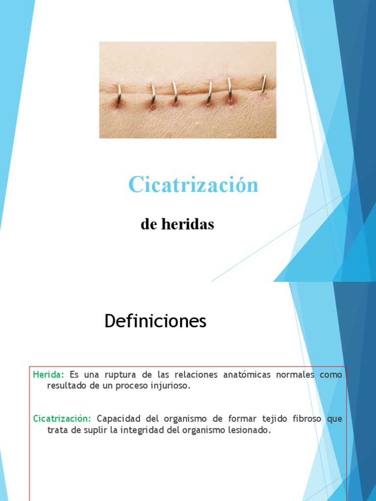 Cicatriz | PDF | Cicatrización de la herida | Inflamación