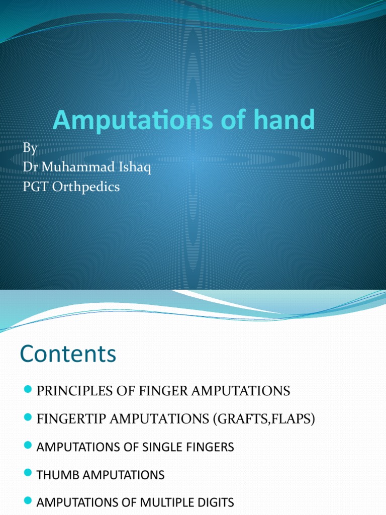 Amputations of Hand | PDF | Finger | Hand