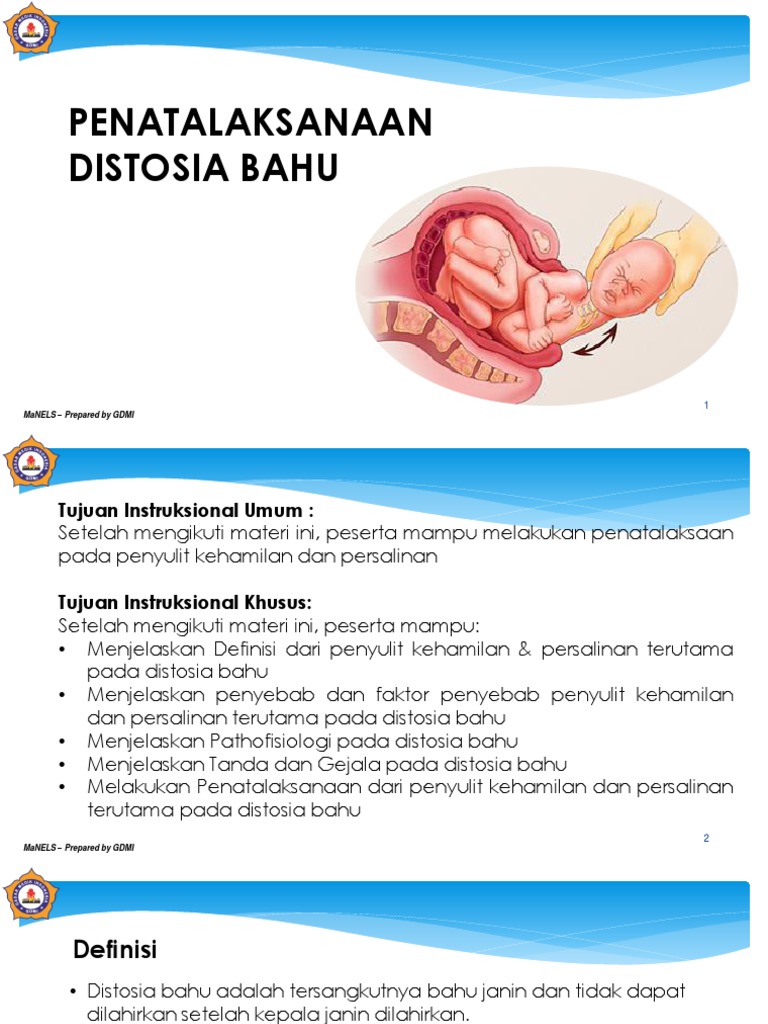 Slide 8 Distosia Bahu | PDF