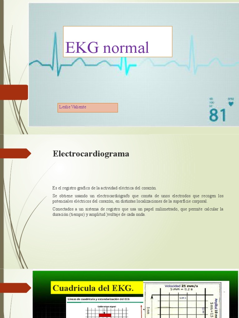 Análisis del Electrocardiograma EKG | PDF | Electrocardiografia ...