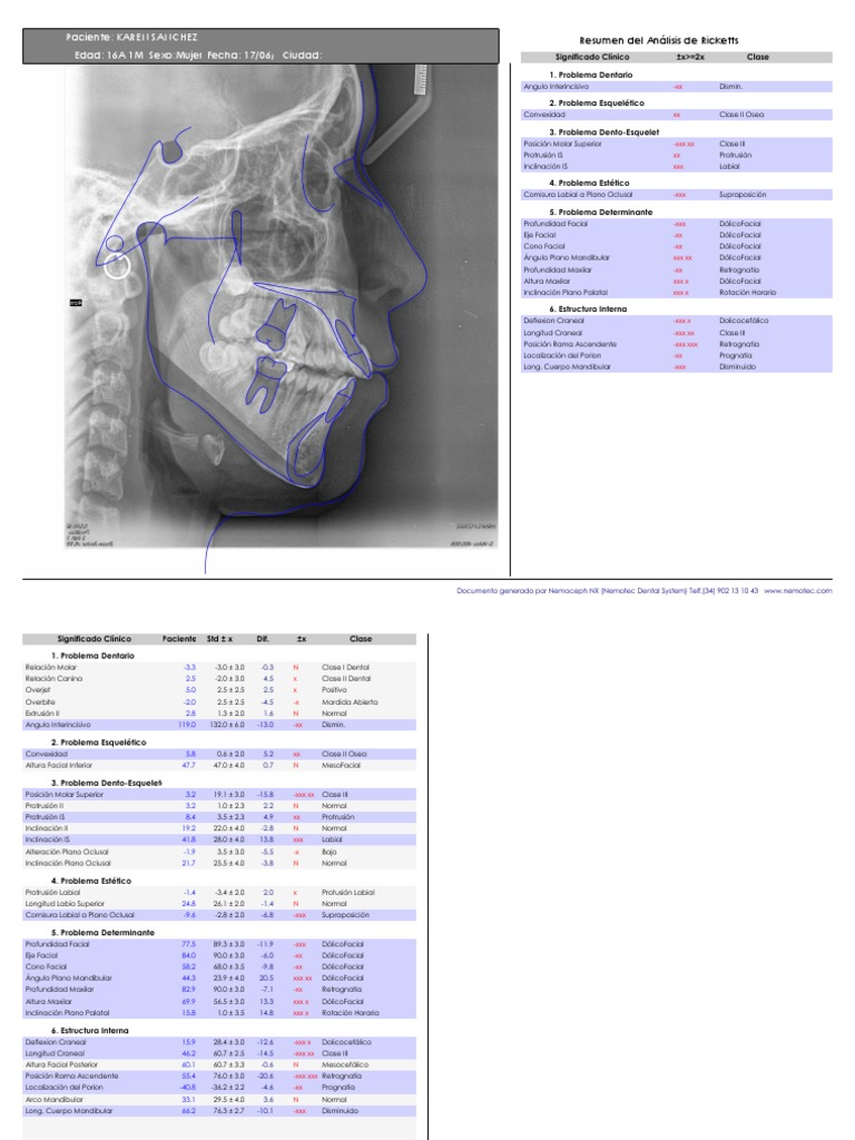 Análisis Ricketts: Diagnóstico DolicoFacial | PDF | Anatomia dental ...
