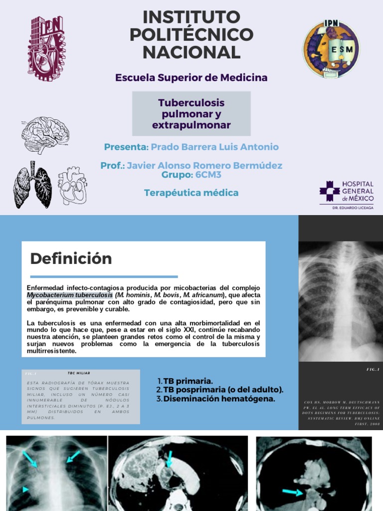 Tuberculosis Pulmonar y Extrapulmonar PDF | PDF | Tuberculosis ...