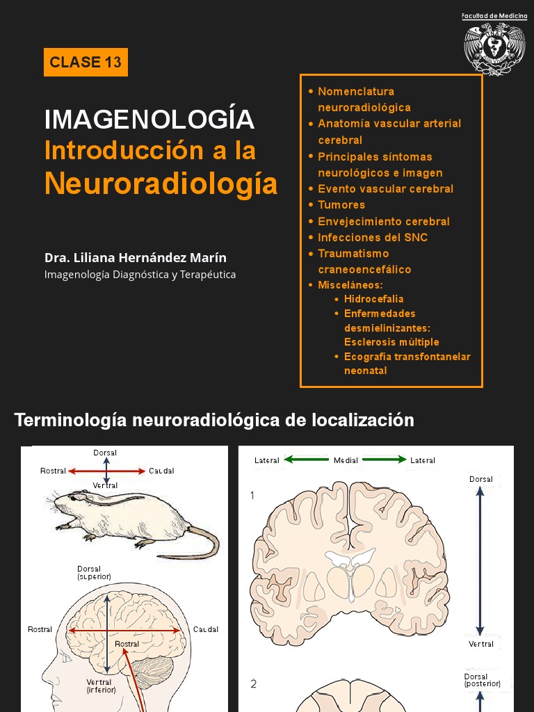 SESIÓN 13 - Neuroradiología | PDF | Fluido cerebroespinal | Epilepsia