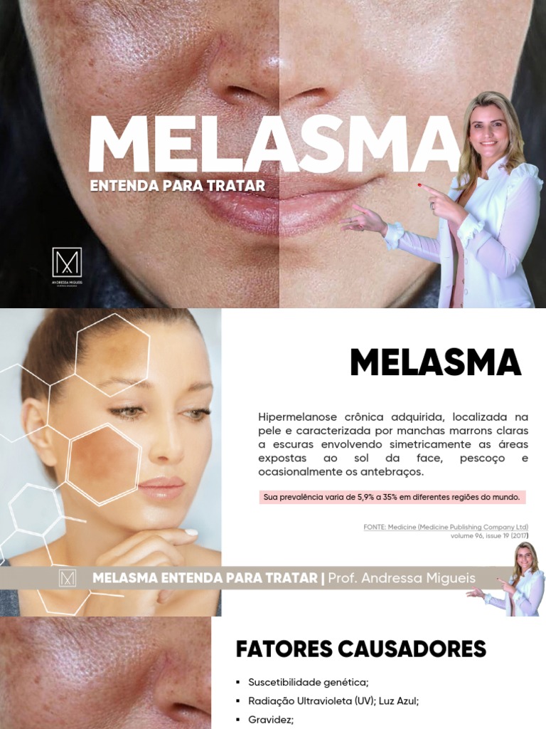 Melasma telegram | PDF | Pele | Ultravioleta