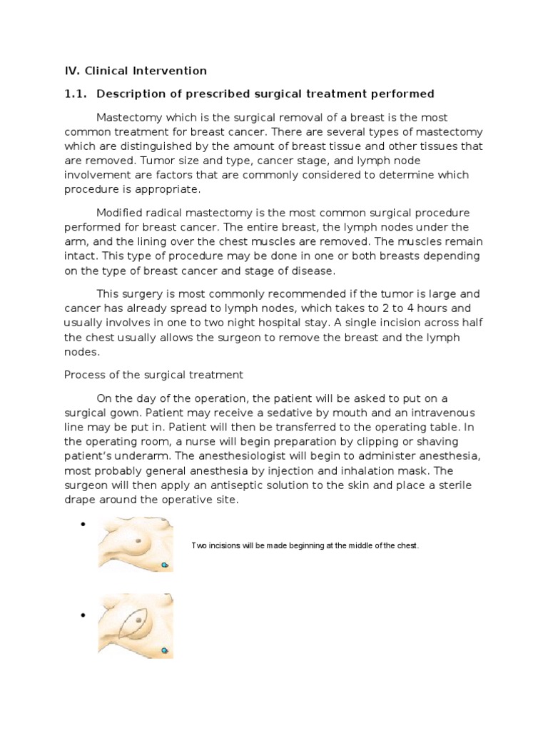 Casereport-Modified Radical Mastectomy | PDF | Mastectomy | Surgery