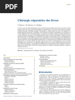 54 - Tamponnement Nasal Anterieur | PDF | Tête et cou chez l'humain ...
