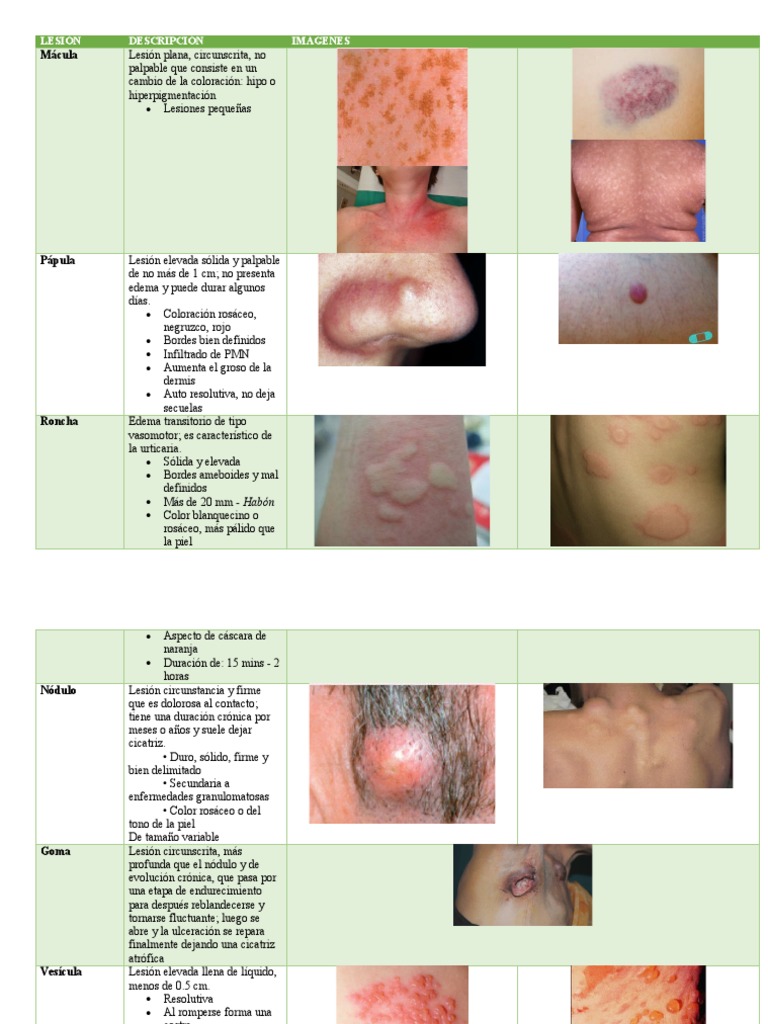 Mácula: Lesión Descripción Imágenes | PDF | Dermatología | Epidemiología
