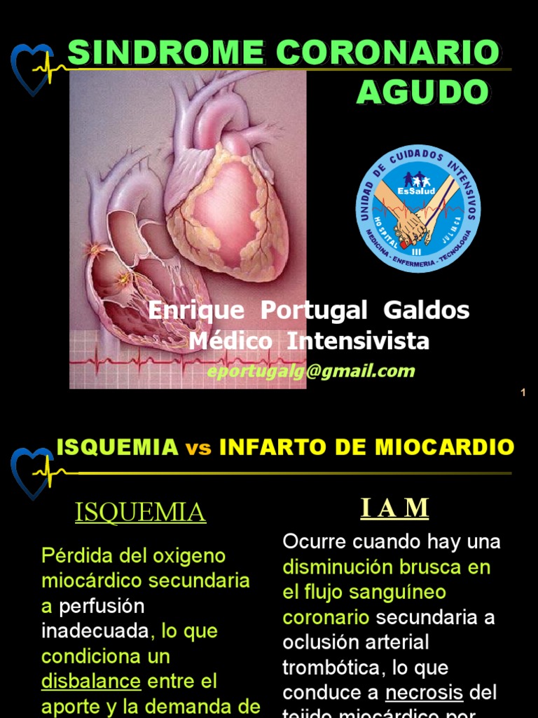 Curso ECG - 6 Infarto Agudo de Miocardio | PDF | Infarto de miocardio ...