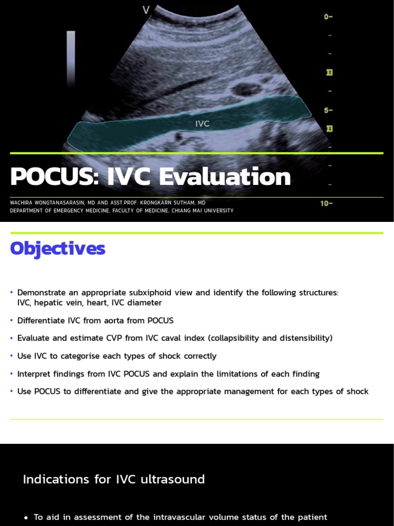 POCUS IVC-shock PDF | PDF | Shock (Circulatory) | Human Diseases And ...