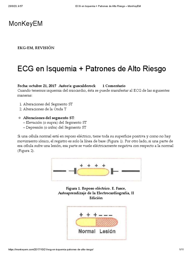 ECG en Isquemia + Patrones de Alto Riesgo - MonKeyEM | PDF | Electrocardiografia | Sistema ...