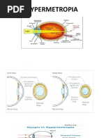 ADF Vision Requirements General | PDF | Visual Acuity | Myopia