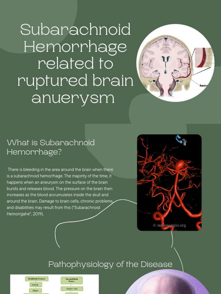 A1 EMERGENCY PPT Subarachnoid Hemorrhage | PDF | Traumatic Brain Injury ...