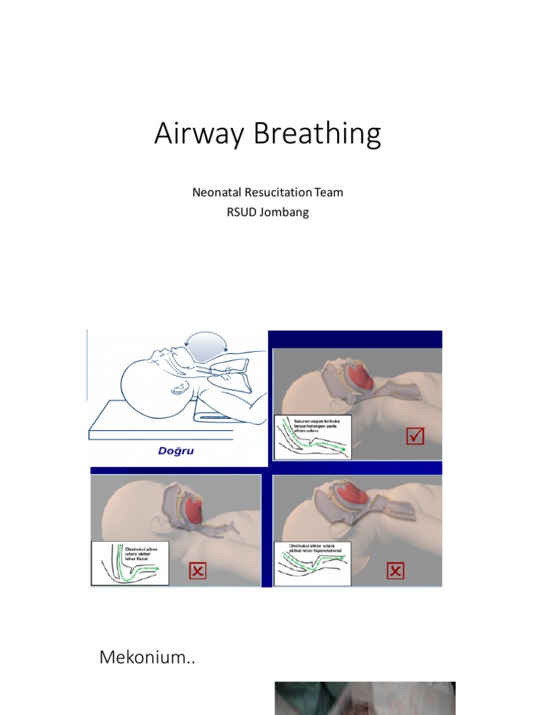 Airway Breathing | PDF