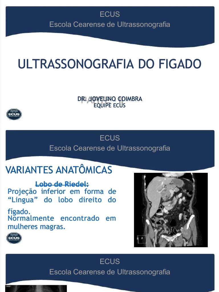 PDF Ultrassonografia Do Figado Patologias - Compress | PDF | Fígado ... PDF Ultrassonografia Do Figado Patologias - Compress | PDF | Fígado ...