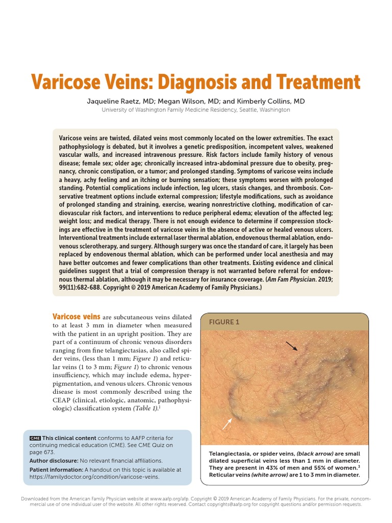Varicose Veins Diagnosis and Treatment | Download Free PDF | Varicose Veins | Vein