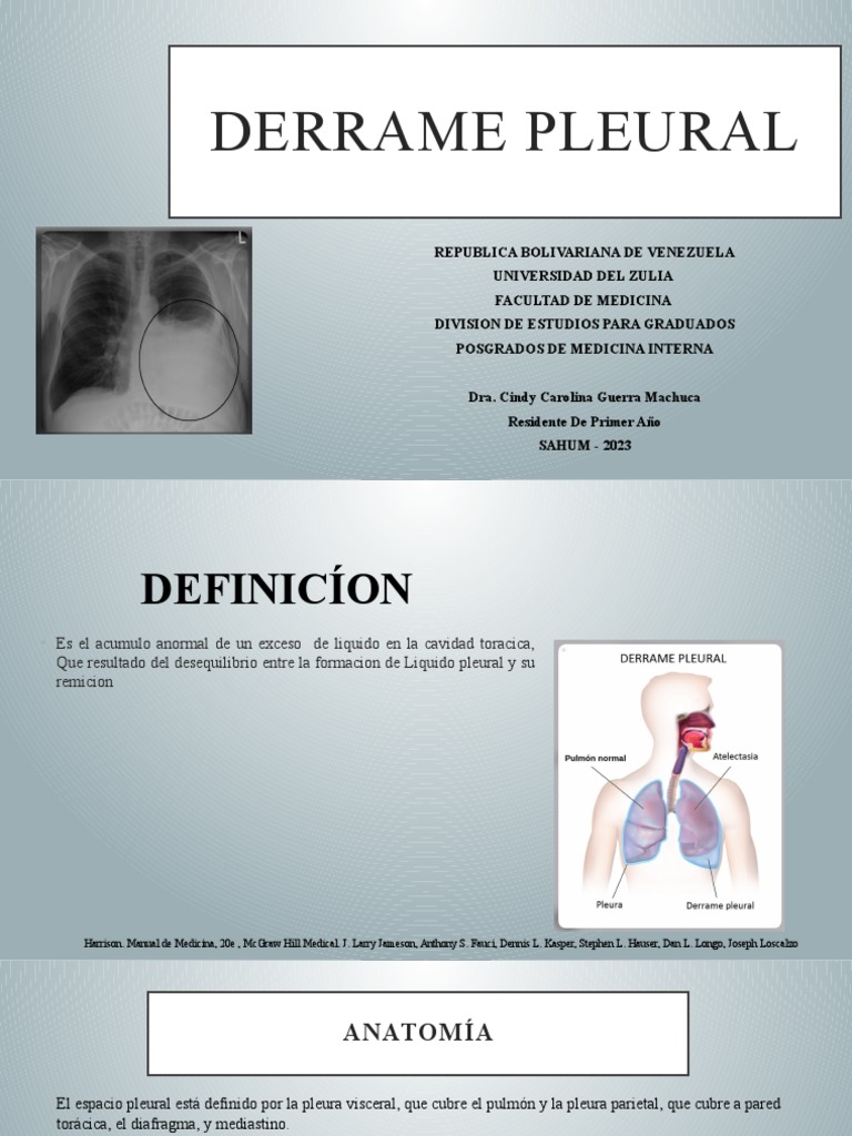 Derrame Pleural | PDF | Medicina CLINICA | Especialidades Medicas
