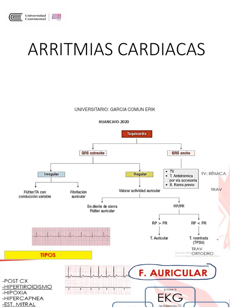 Arritmias Cardiacas | PDF