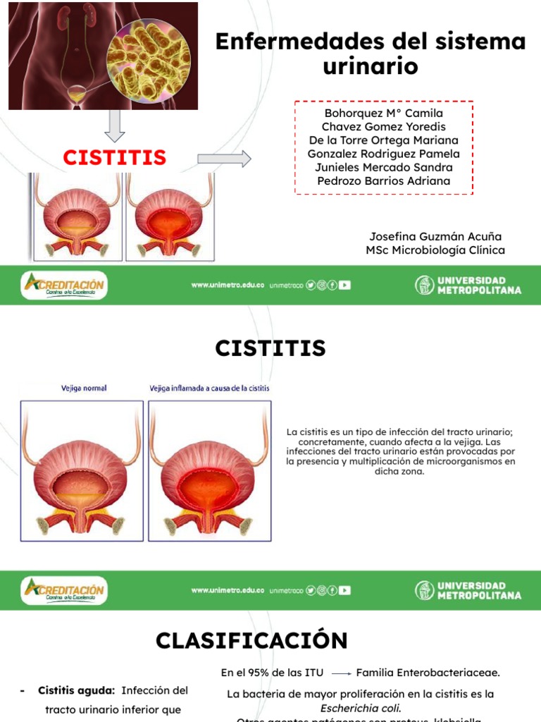 CISTITIS | PDF | Infección del tracto urinario | Las bacterias